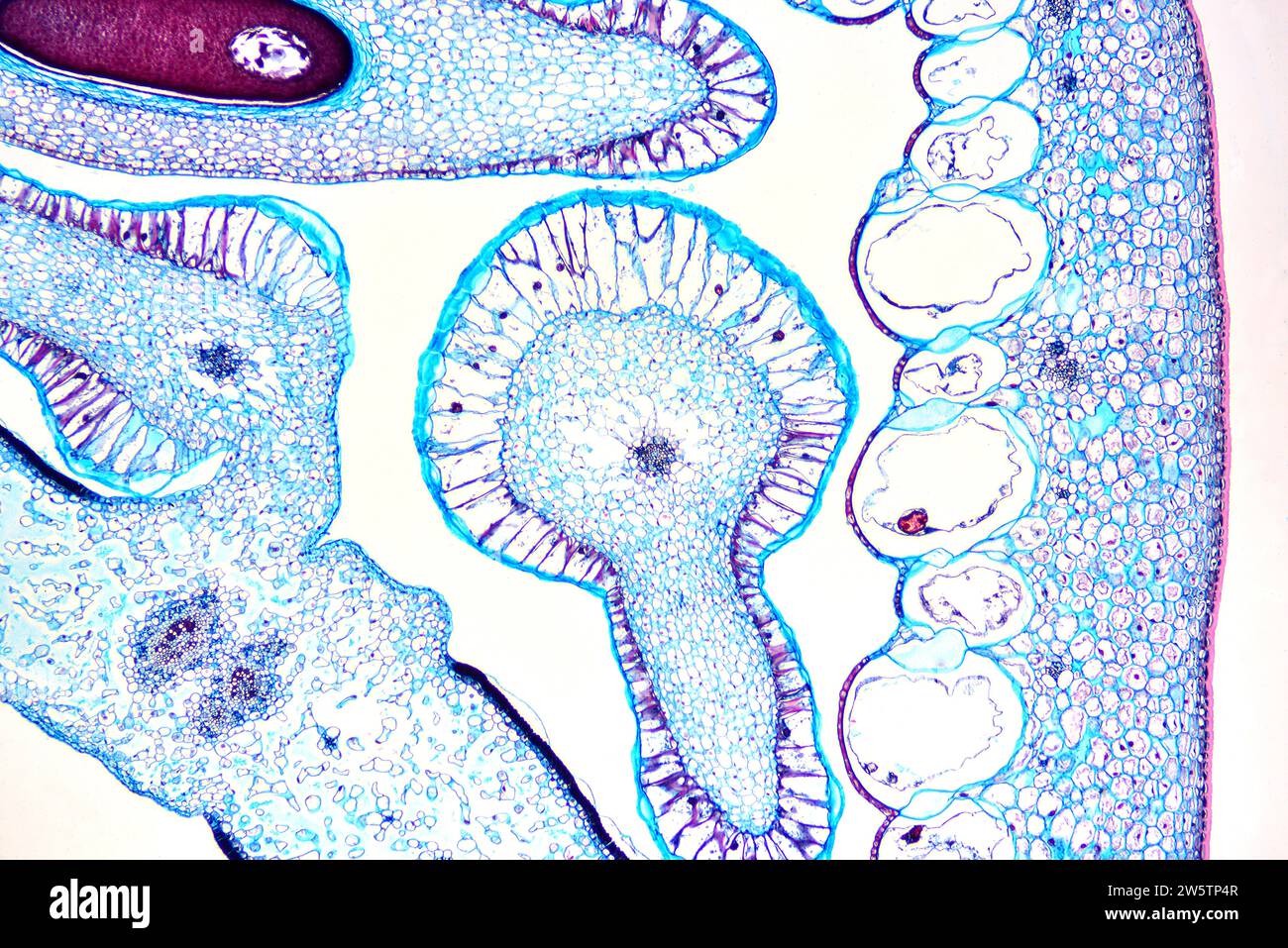 Embryo of pepper (Capsicum annuum). Photomicrograph X20 at 10 cm wide ...