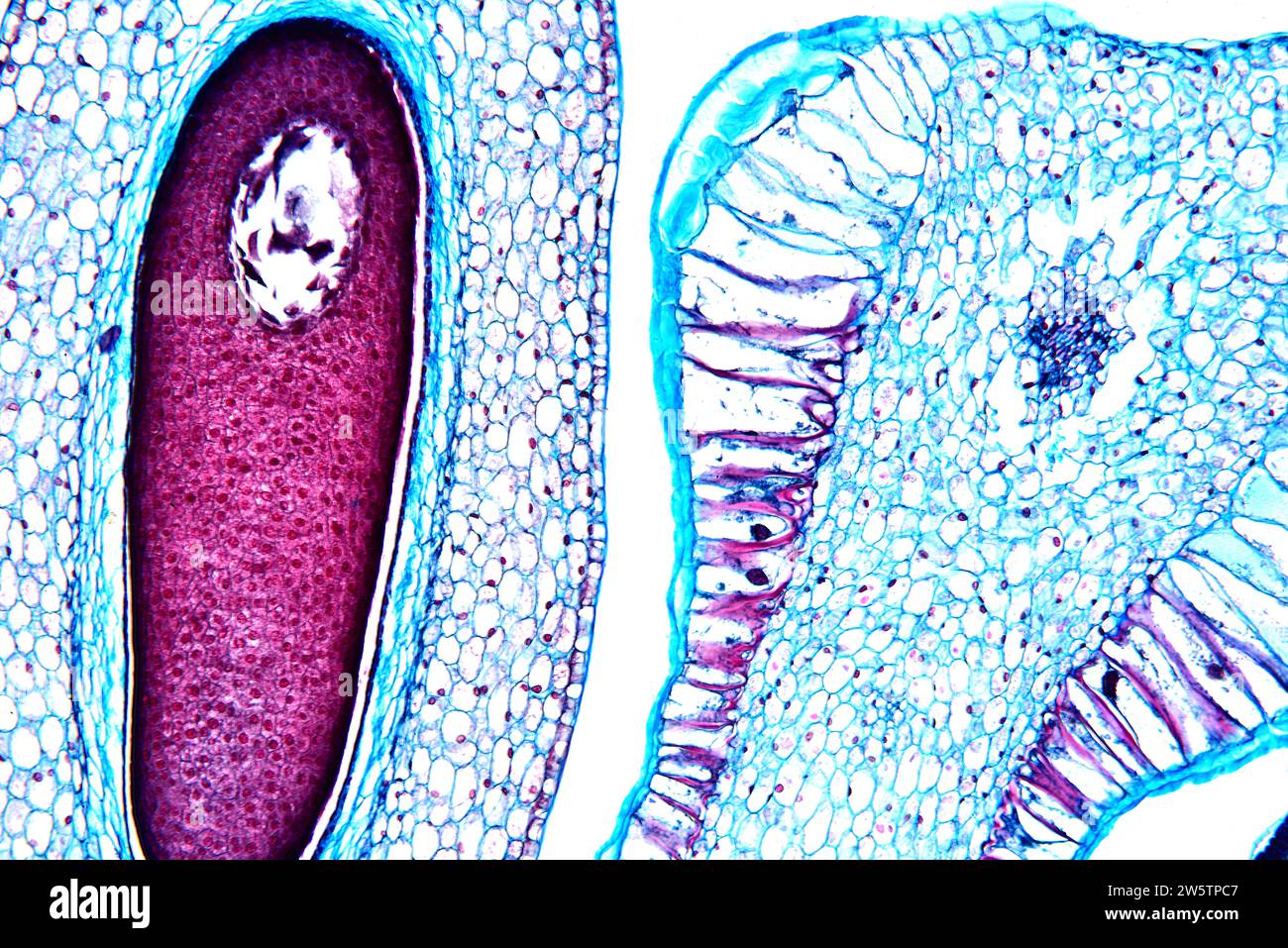 Embryo of pepper (Capsicum annuum). Photomicrograph X50 at 10 cm wide ...