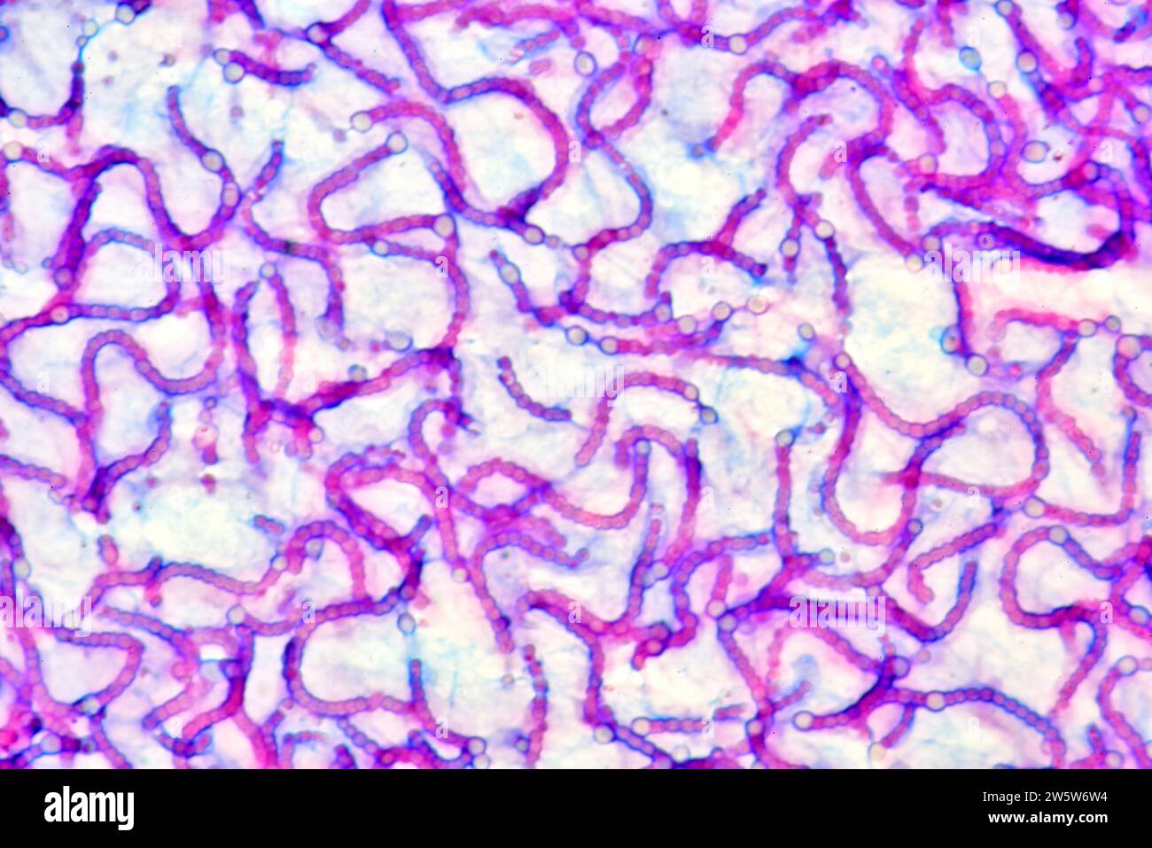 Nostoc colonies with heterocysts. Photomicrogrph X400 at 10 cm wide ...