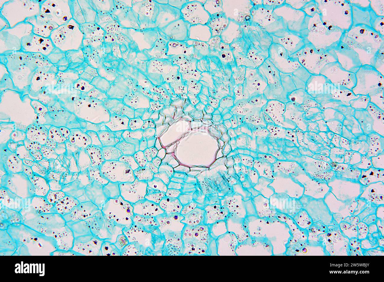 Tuberous root of sweet potato (Ipomoea batatas) showing amyloplasts ...