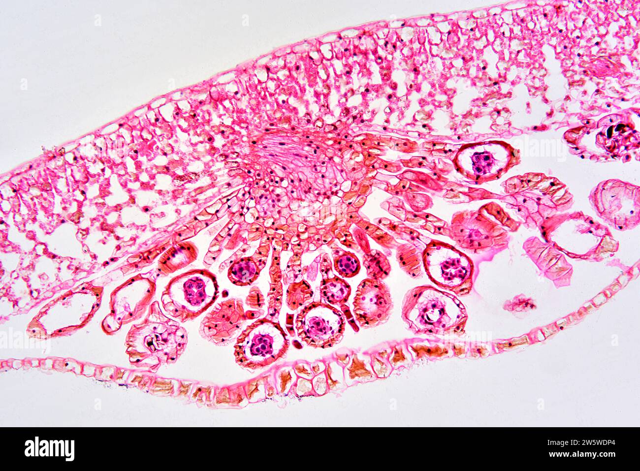 Sorus of fern with sporangia and spores. Photomicrograph X50 at 10 cm ...