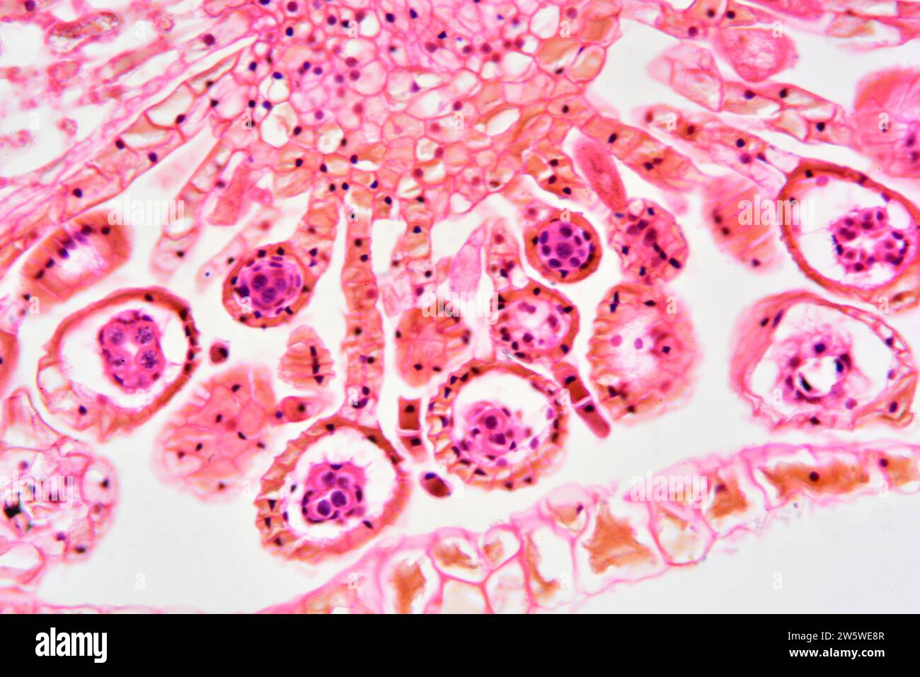 Sorus of fern with sporangia and spores. Photomicrograph X100 at 10 cm ...