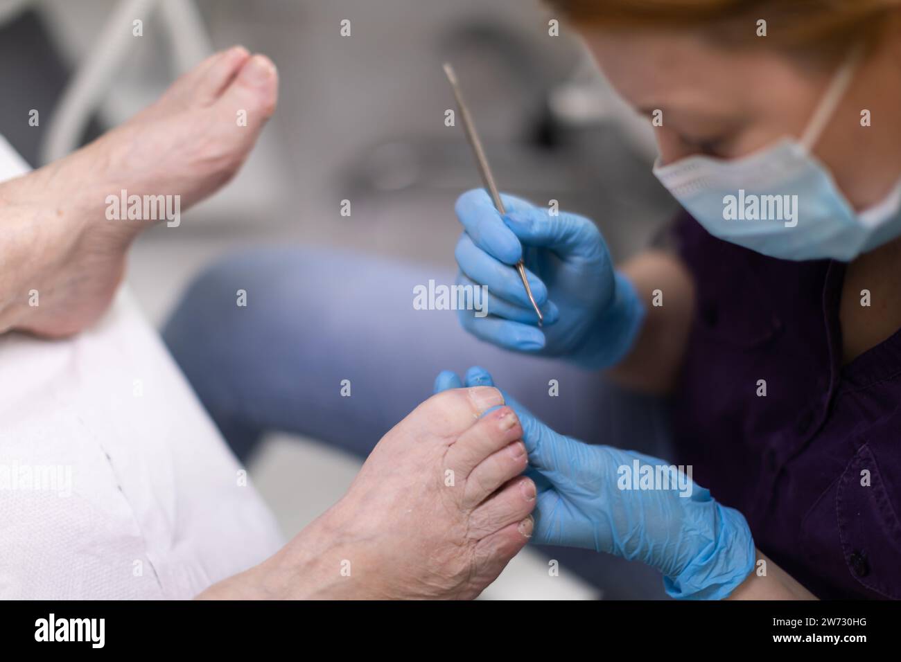 The podiatrist carefully cuts her patient's hard toenails Stock Photo ...