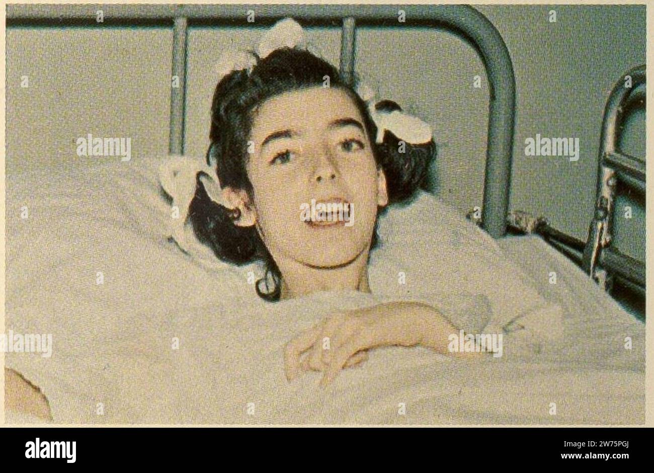 Wilson's disease hi-res stock photography and images - Alamy