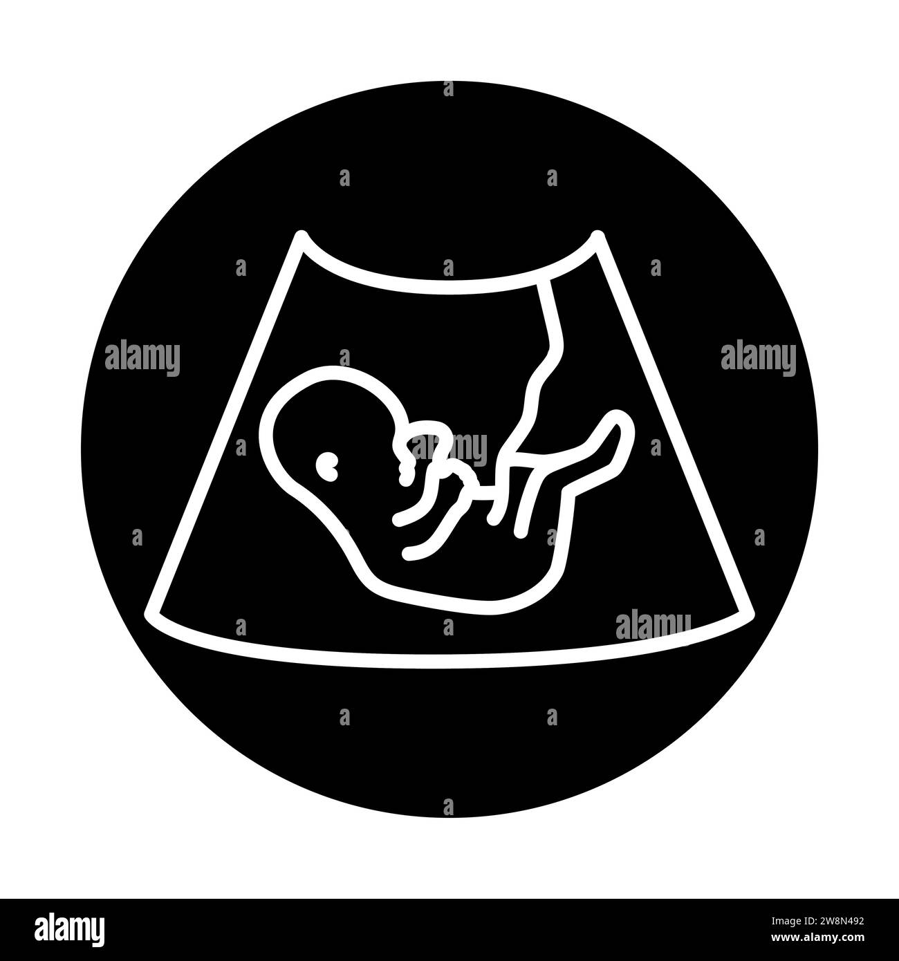 Preimplantation Stock Vector Images - Alamy