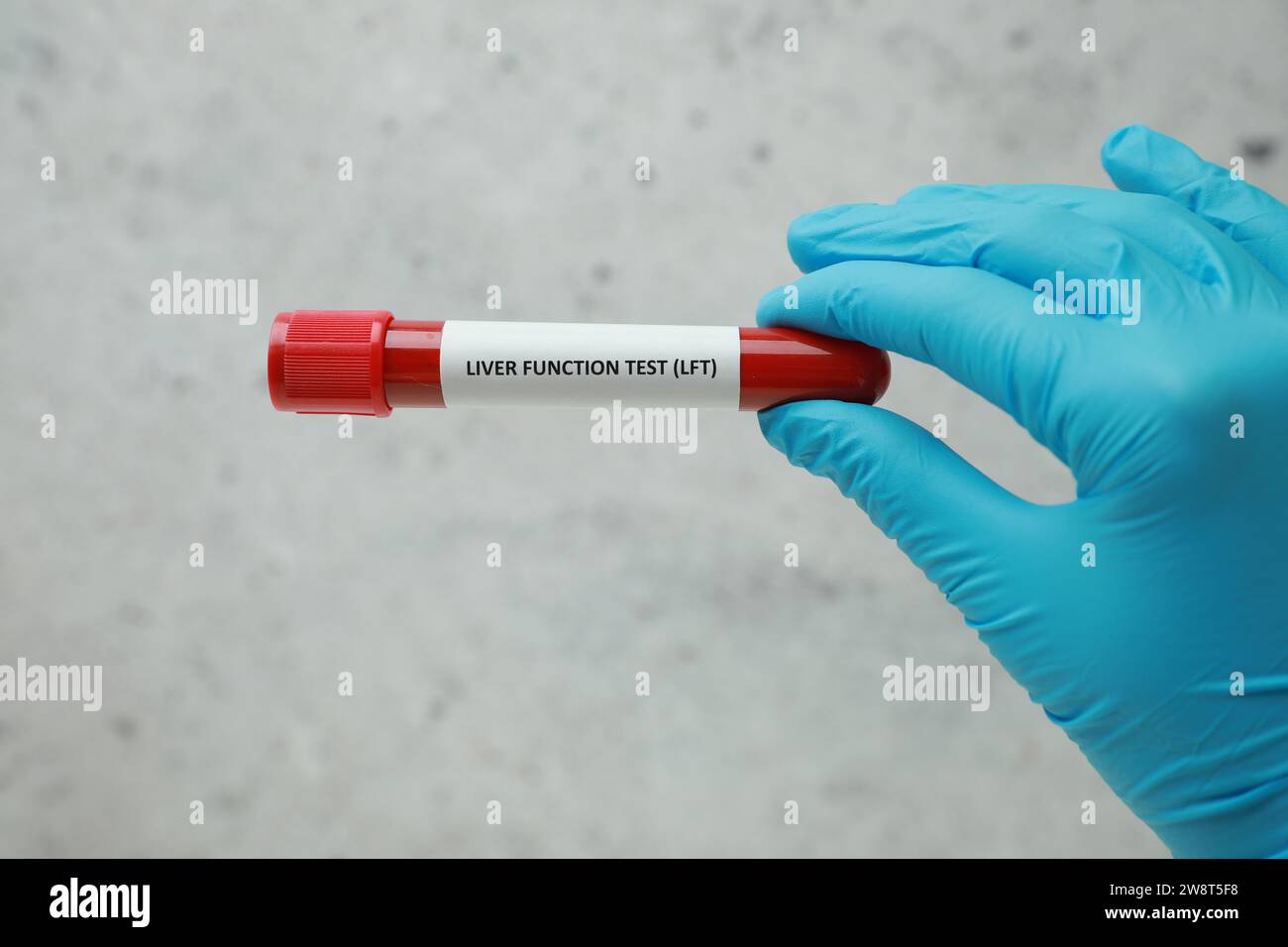 Laboratory worker holding tube with blood sample and label Liver ...
