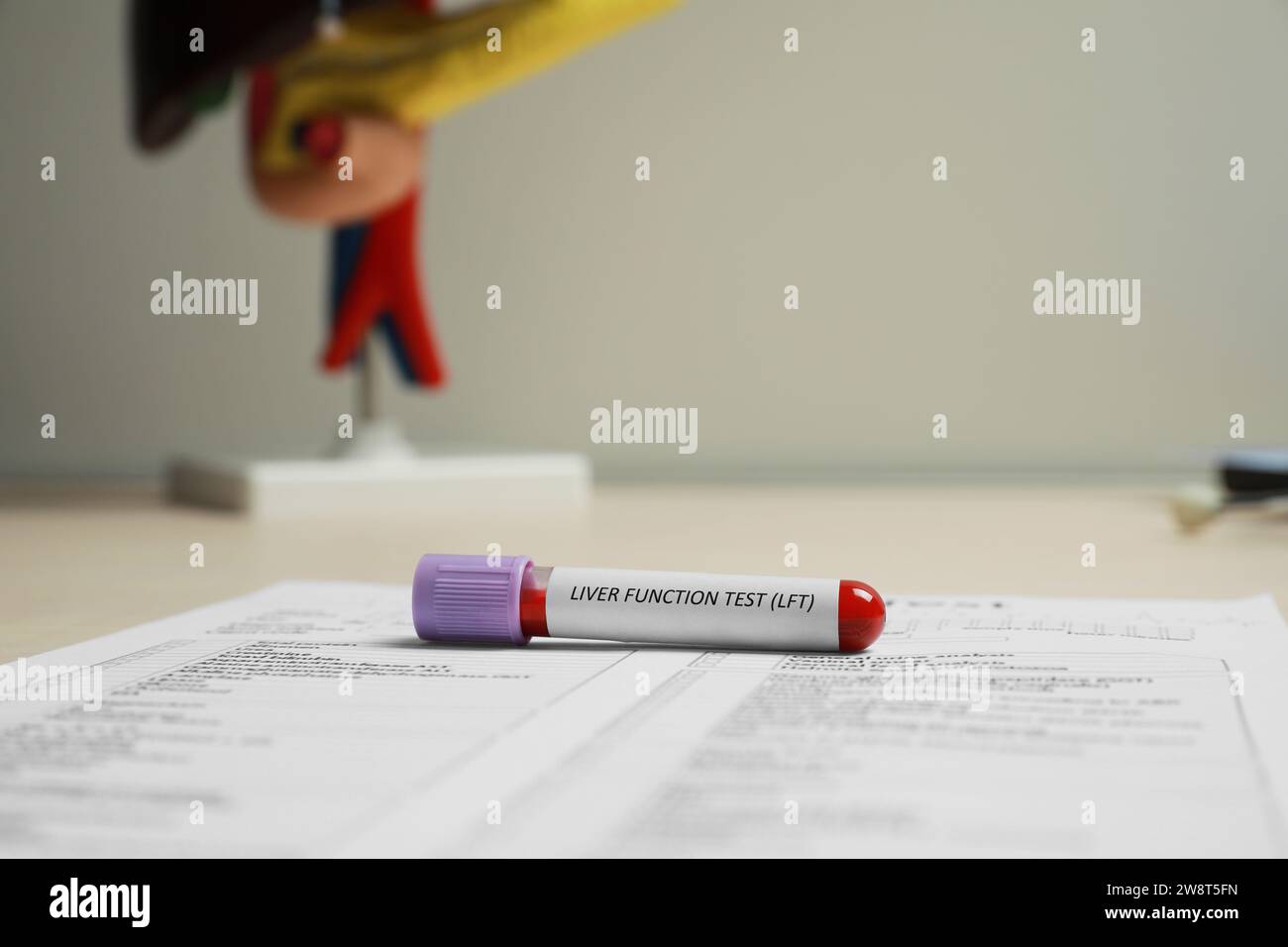 Liver Function Test. Tube with blood sample and laboratory form on ...
