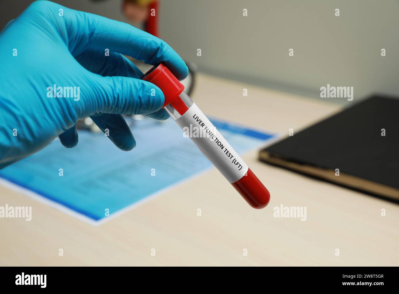 Laboratory worker holding tube with blood sample and label Liver ...