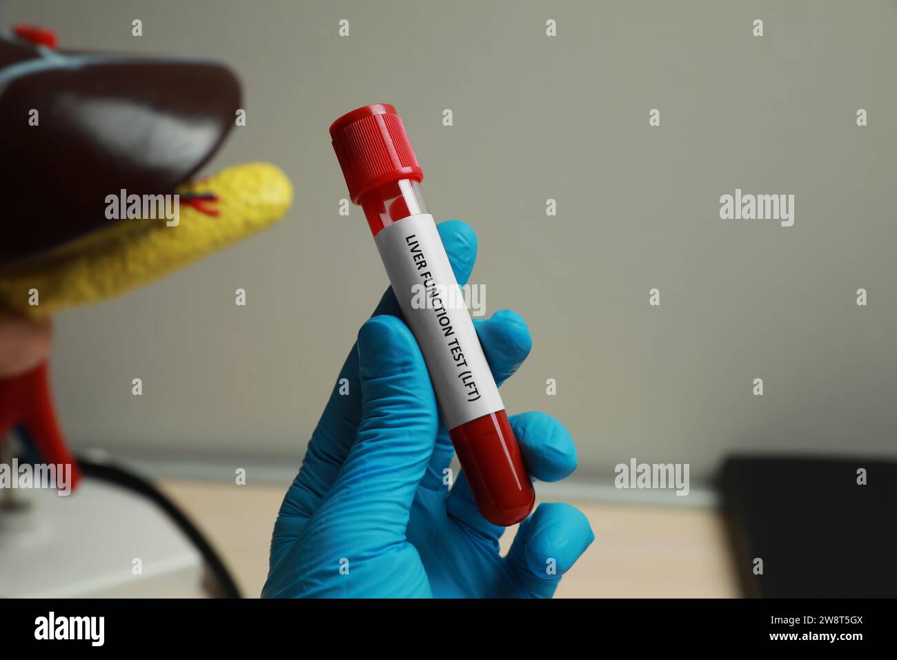 Laboratory worker holding tube with blood sample and label Liver ...