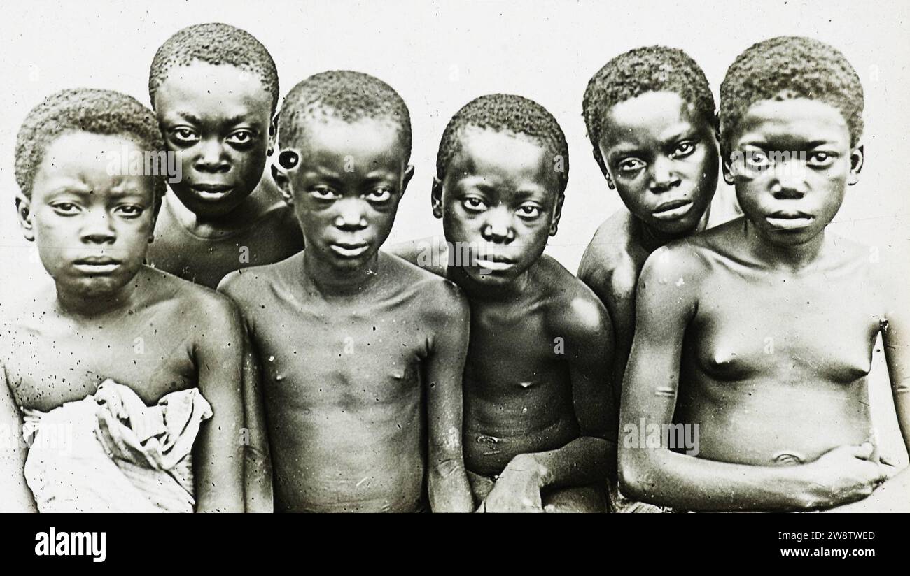 Young girlies at Yaseki, Congo, ca. 1900-1915 (IMP-CSCNWW33-OS11-6 Stock Photo - Alamy