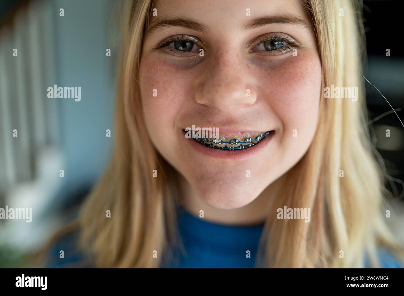 Tween girl close up smiling with braces on teeth Stock Photo - Alamy