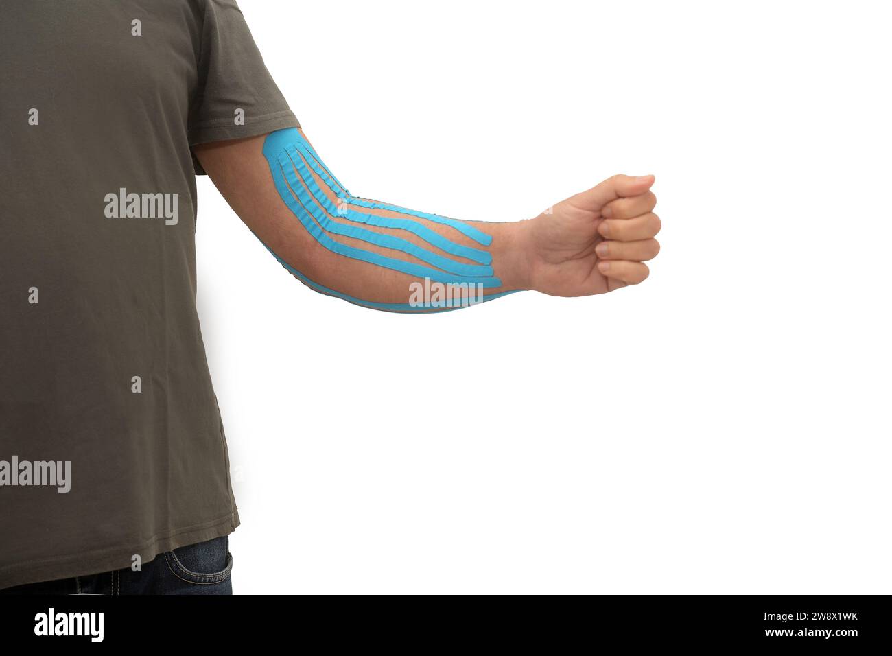 Elbow fracture with taping applied to a man's arm Stock Photo - Alamy