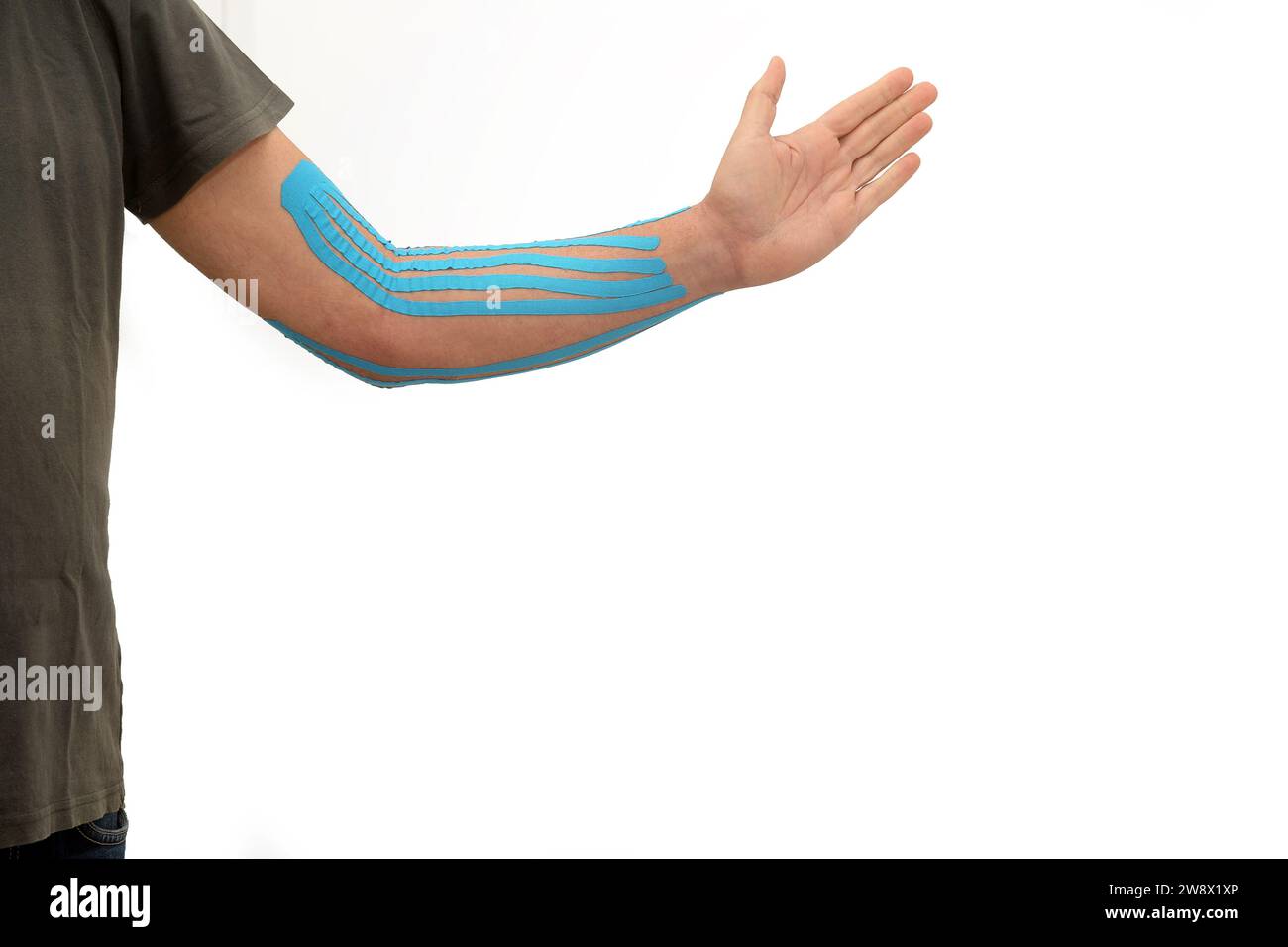 Elbow fracture with taping applied to a man's arm Stock Photo - Alamy