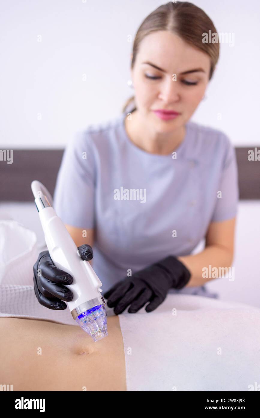 Microneedle RF lifting procedure. Hardware cosmetology. Beautician ...