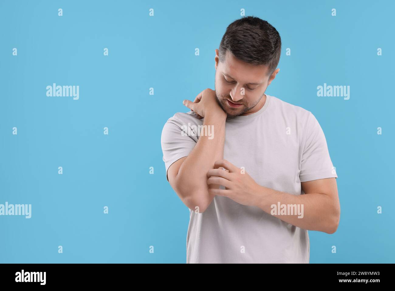 Allergy symptom. Man scratching his arm on light blue background. Space ...