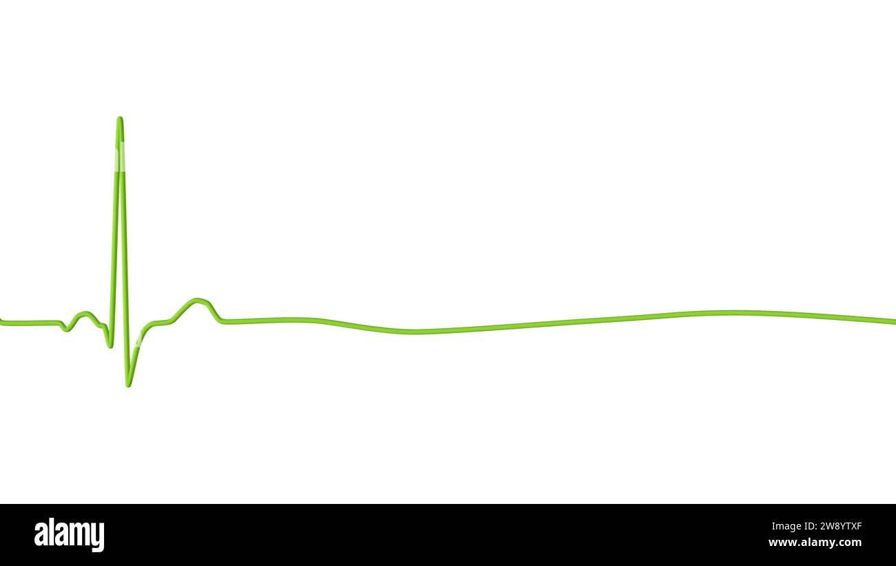 Asystole cardiac arrest, illustration Stock Photo - Alamy