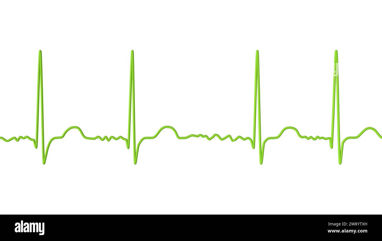 Cardiac fibrillation Cut Out Stock Images & Pictures - Alamy
