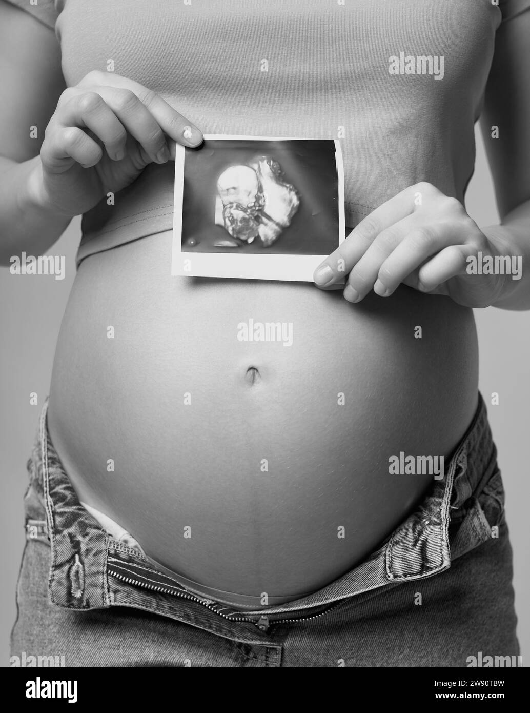 Black and white photo of Pregnant woman with ultrasound scan in hands ...