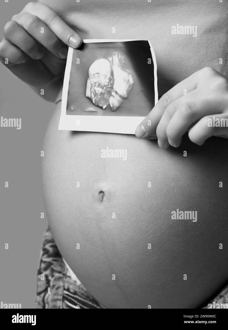 Black and white photo of Pregnant woman with ultrasound scan in hands ...