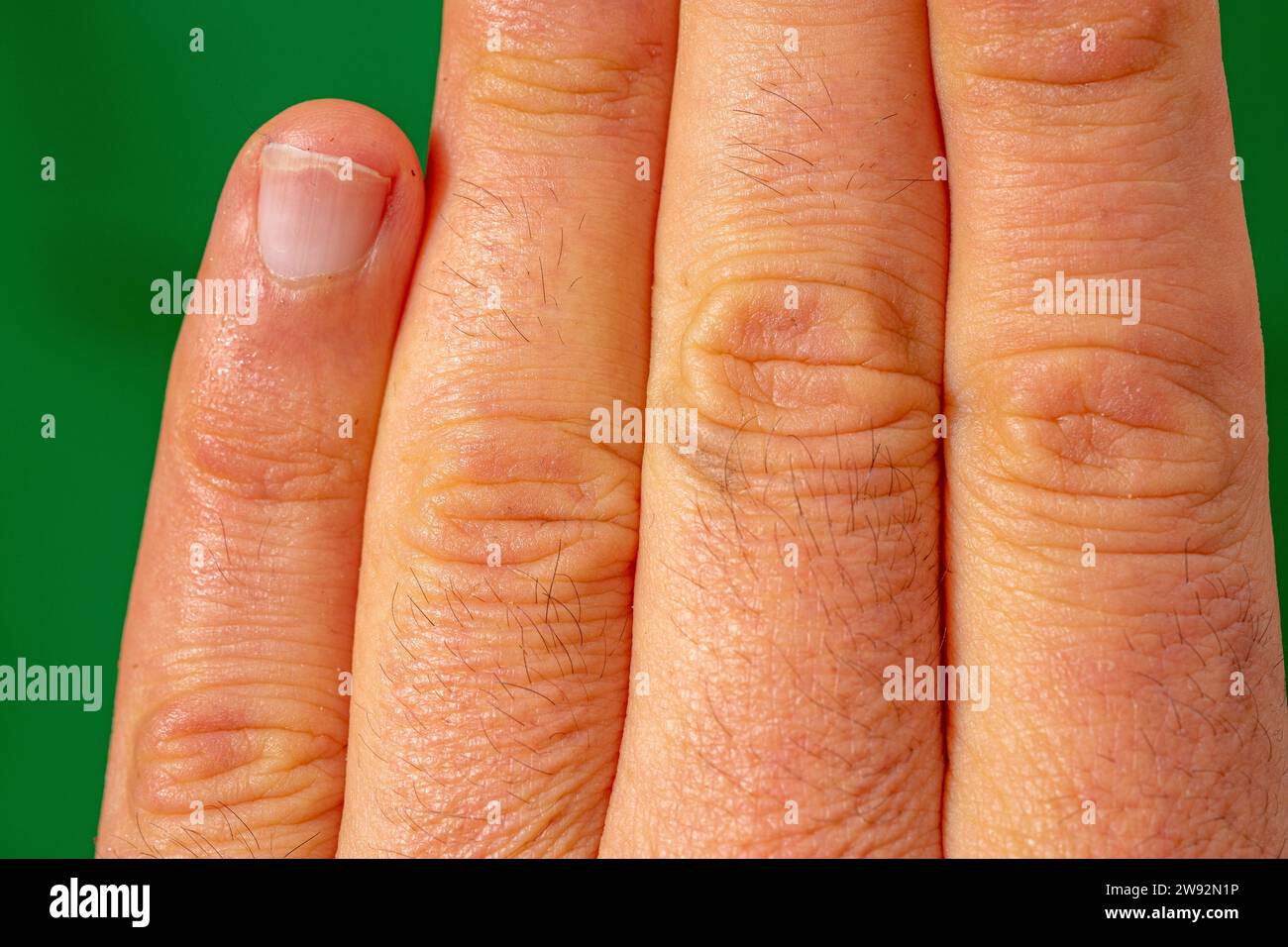 detail of part of 4 man's fingers where it is possible to see the knots ...