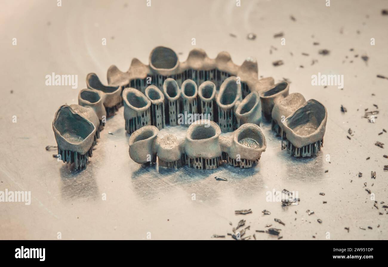 Tooth dental crowns created on 3d printer for metal way selective Laser ...