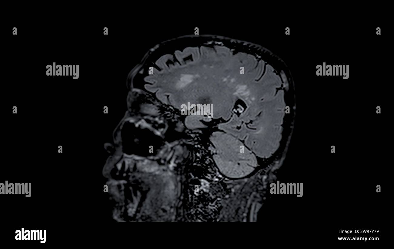 MRI brain scans sagittal view offer valuable insights into brain ...
