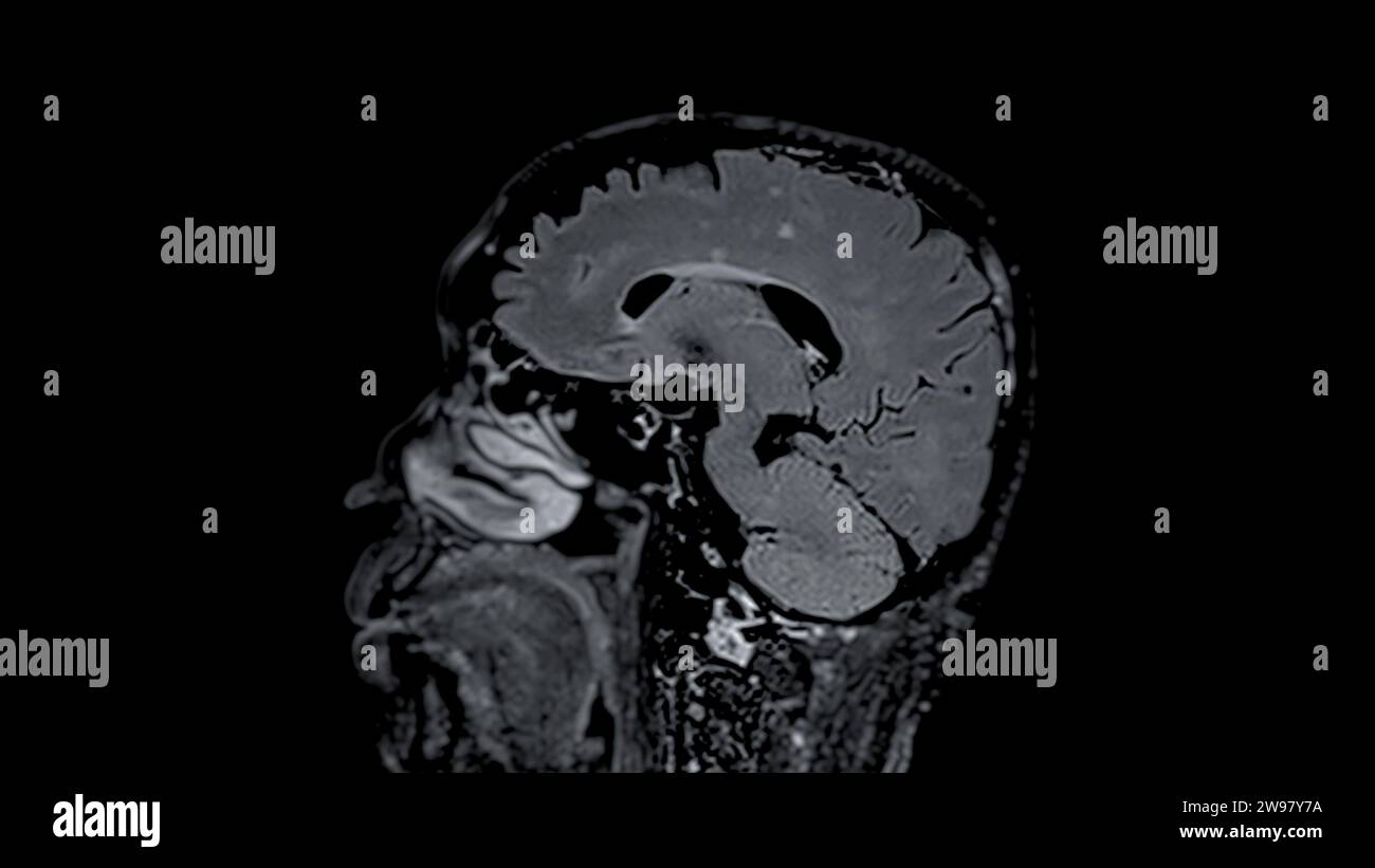 MRI brain scans sagittal view offer valuable insights into brain ...