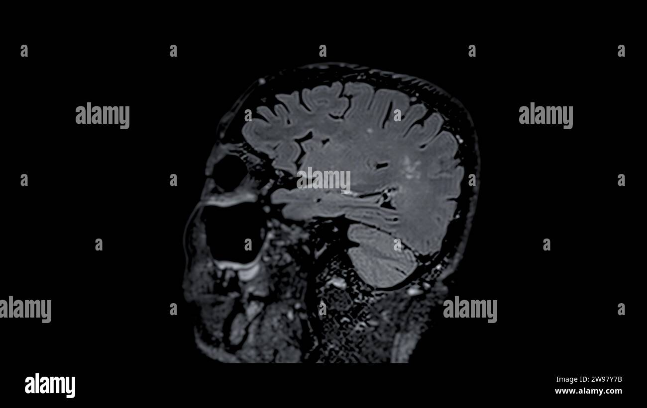 MRI brain scans sagittal view offer valuable insights into brain ...