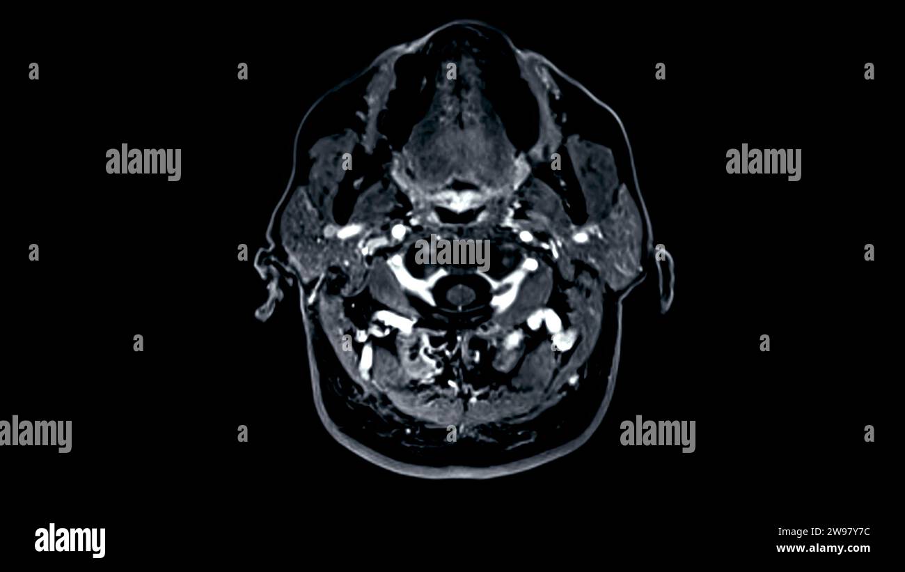 MRI brain scans axial view offer valuable insights into brain anatomy ...