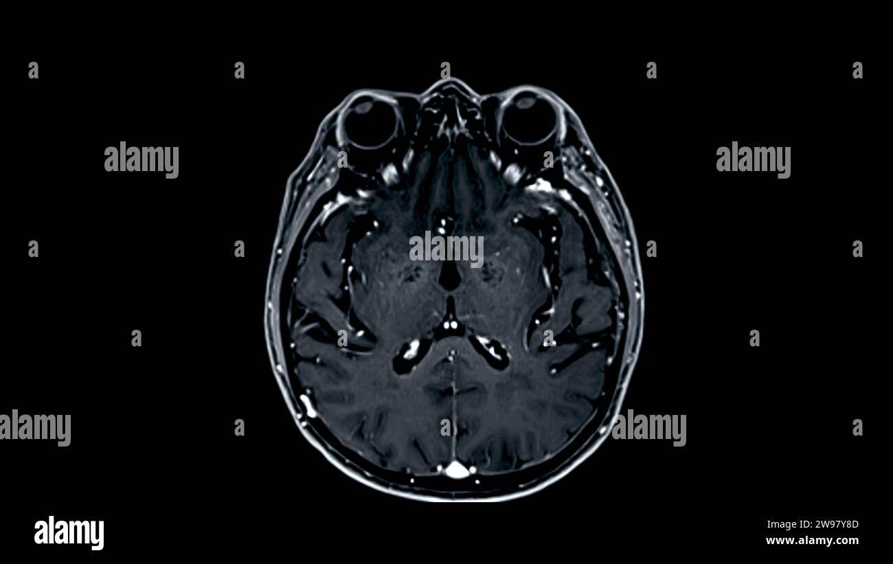 MRI brain scans sagittal view offer valuable insights into brain ...