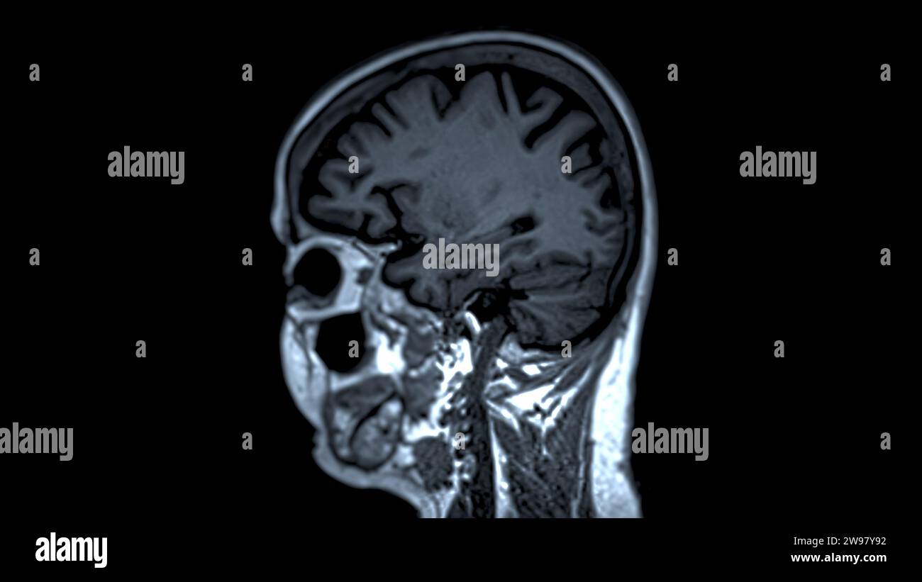 MRI brain scans sagittal view offer valuable insights into brain ...