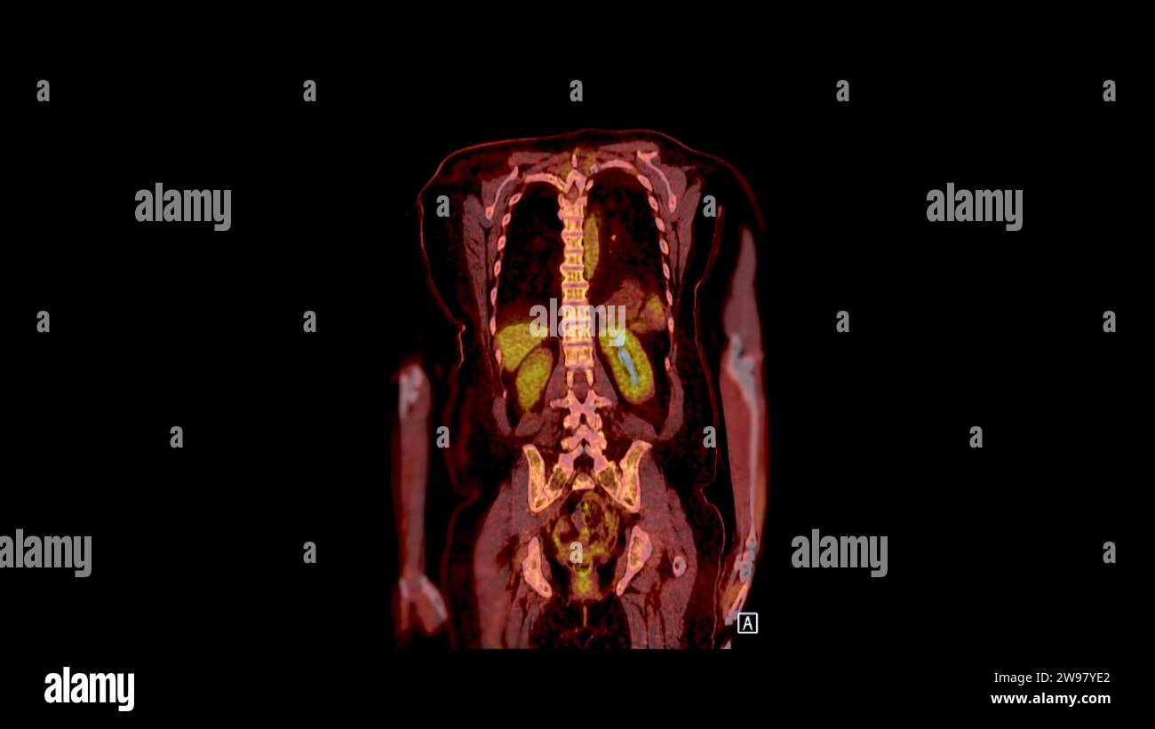 Brain ct scan activity hi-res stock photography and images - Alamy