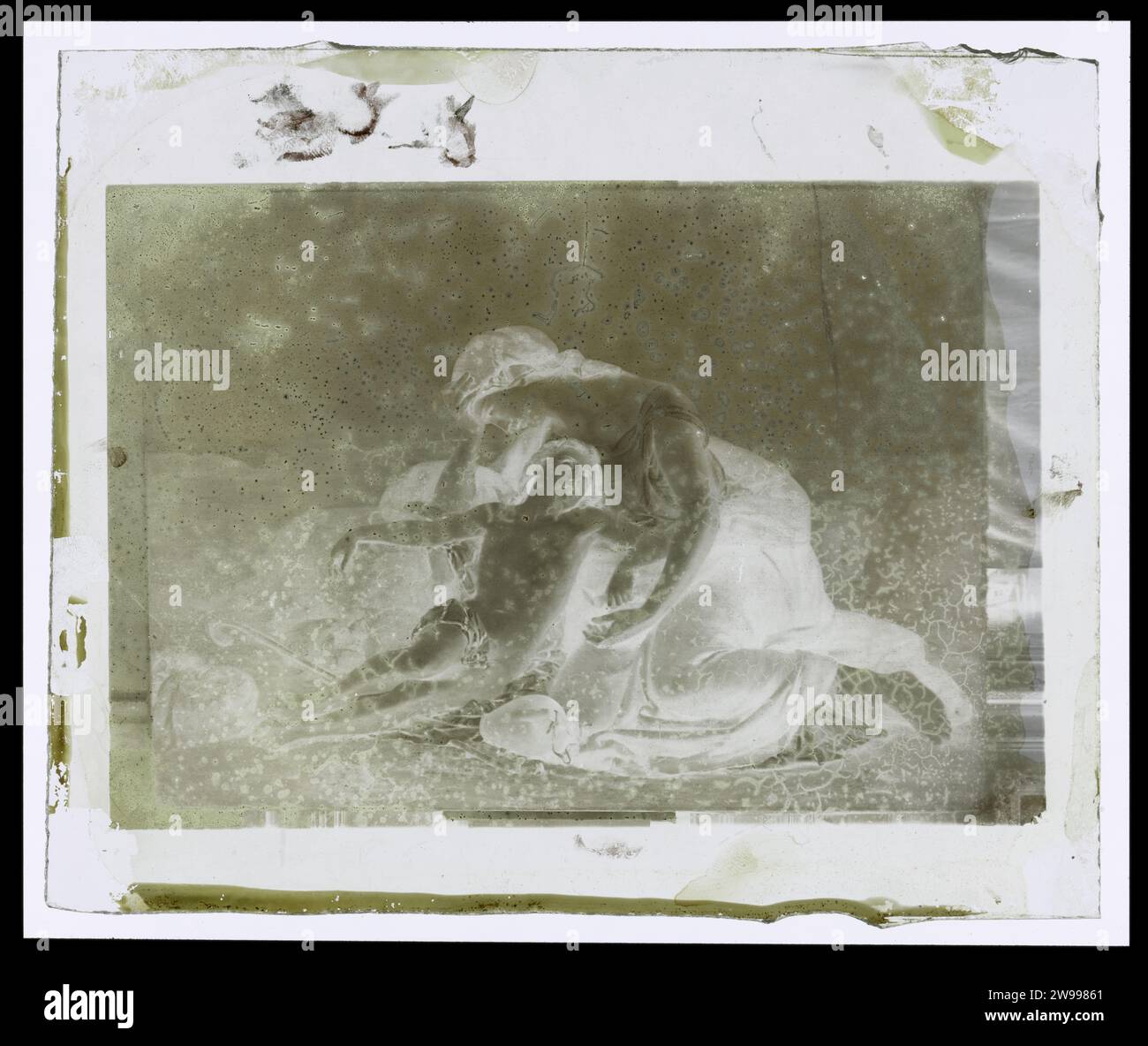 Collodion baby hi-res stock photography and images - Alamy