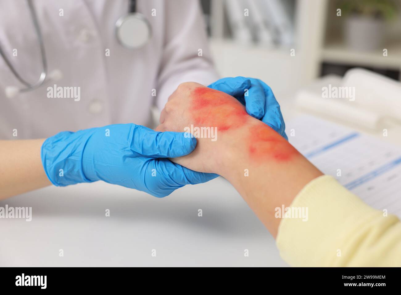 Doctor examining patient's burned hand in hospital, closeup Stock Photo ...