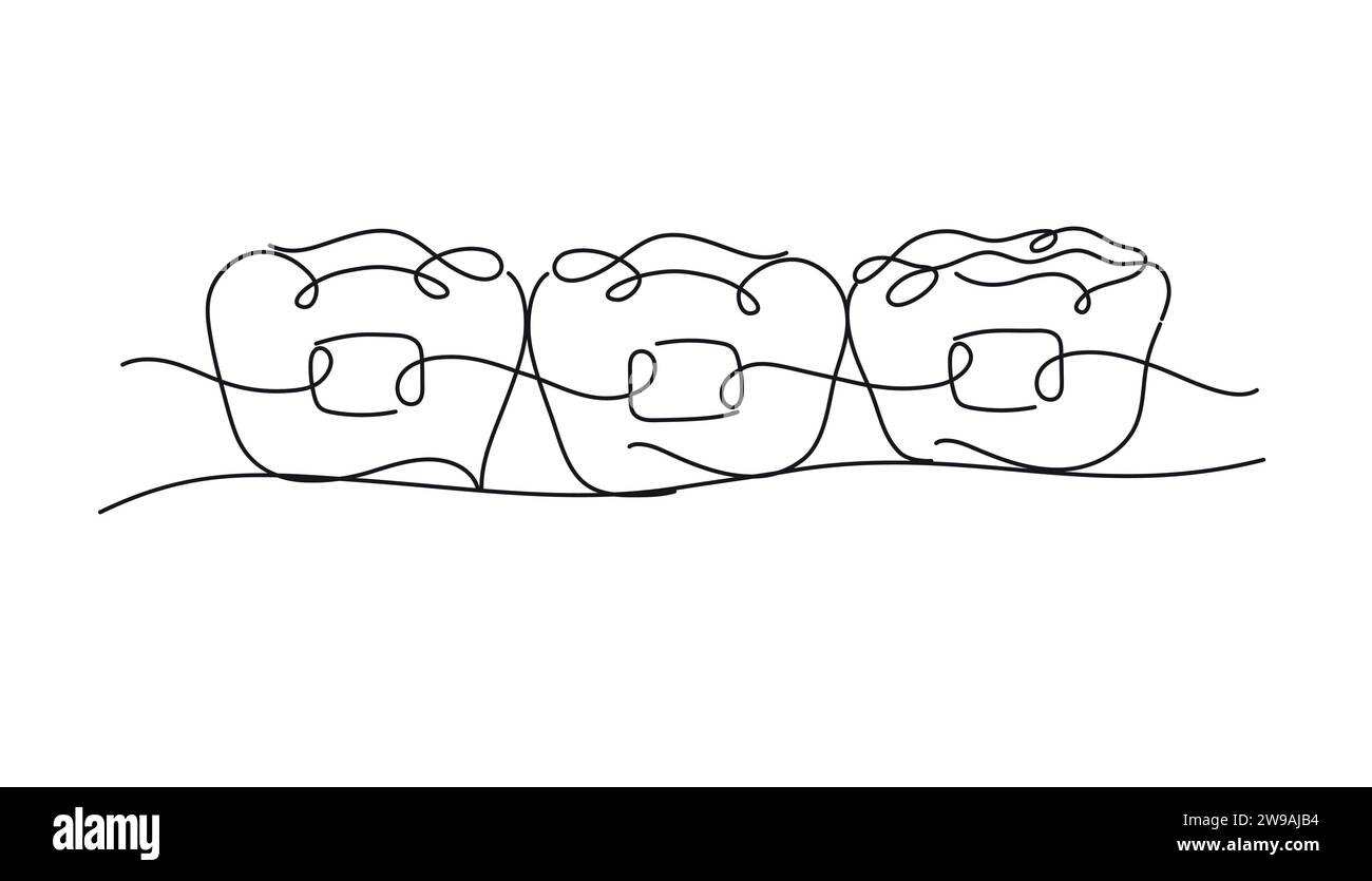 Teeth braces illustration drawing in flat line style on white color ...