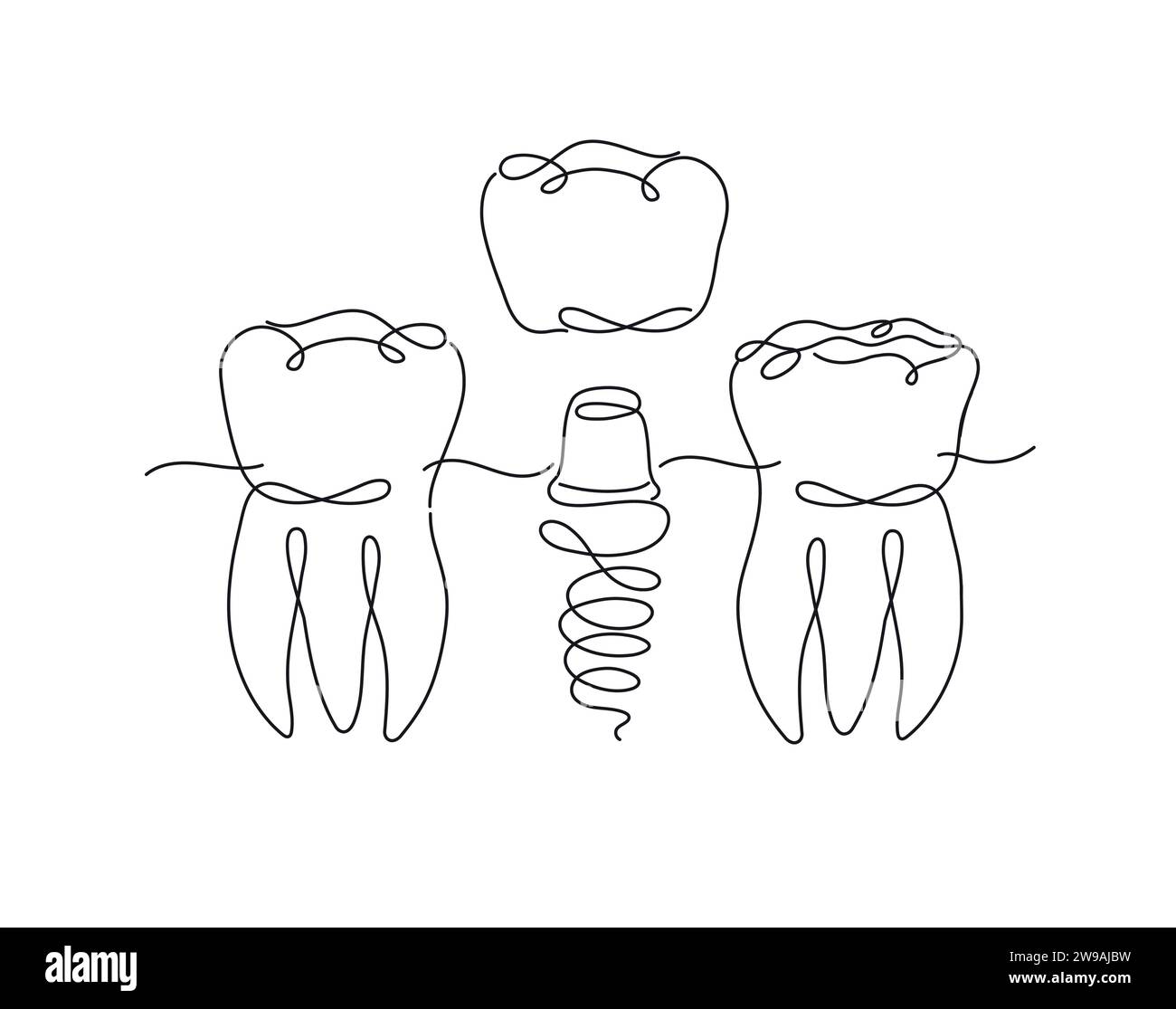 Teeth implant illustration drawing in flat line style on white ...