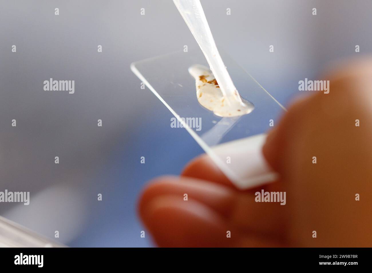 Deborah Pergolotti of Frogsafe Inc. prepares a stool specimen for ...