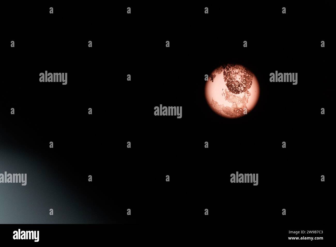 View of a frog's stool sample through a microscope at the Frogsafe Inc ...
