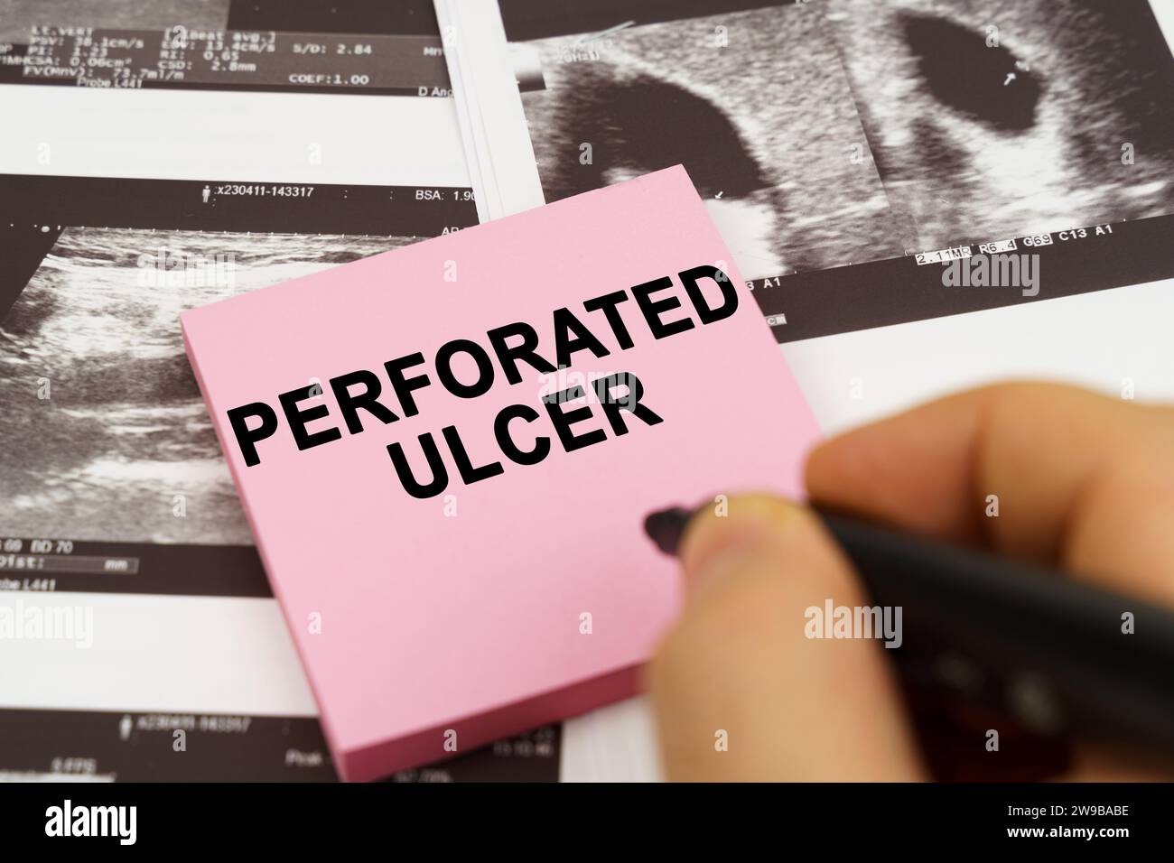 Medical concept. On the ultrasound pictures there are stickers that say ...