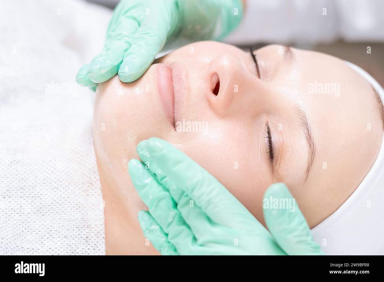 Portrait of a woman's face with problem skin. Peeling procedure ...
