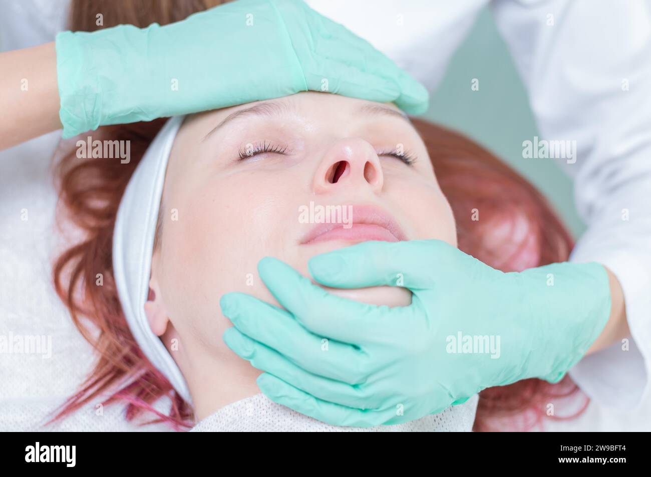 Portrait of a woman's face with problem skin. Peeling procedure ...