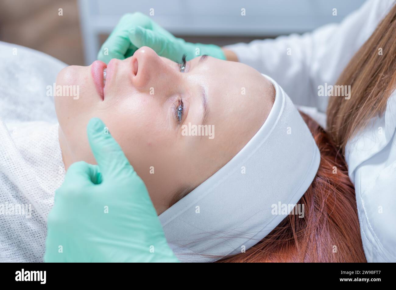 Portrait of a woman's face with problem skin. Peeling procedure ...