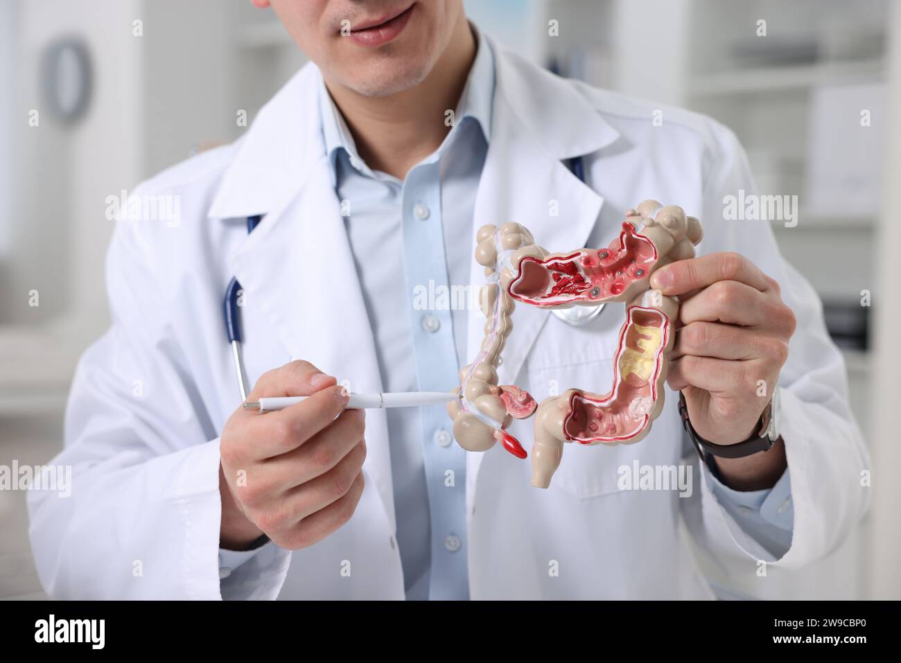 Gastroenterologist showing anatomical model of large intestine in ...