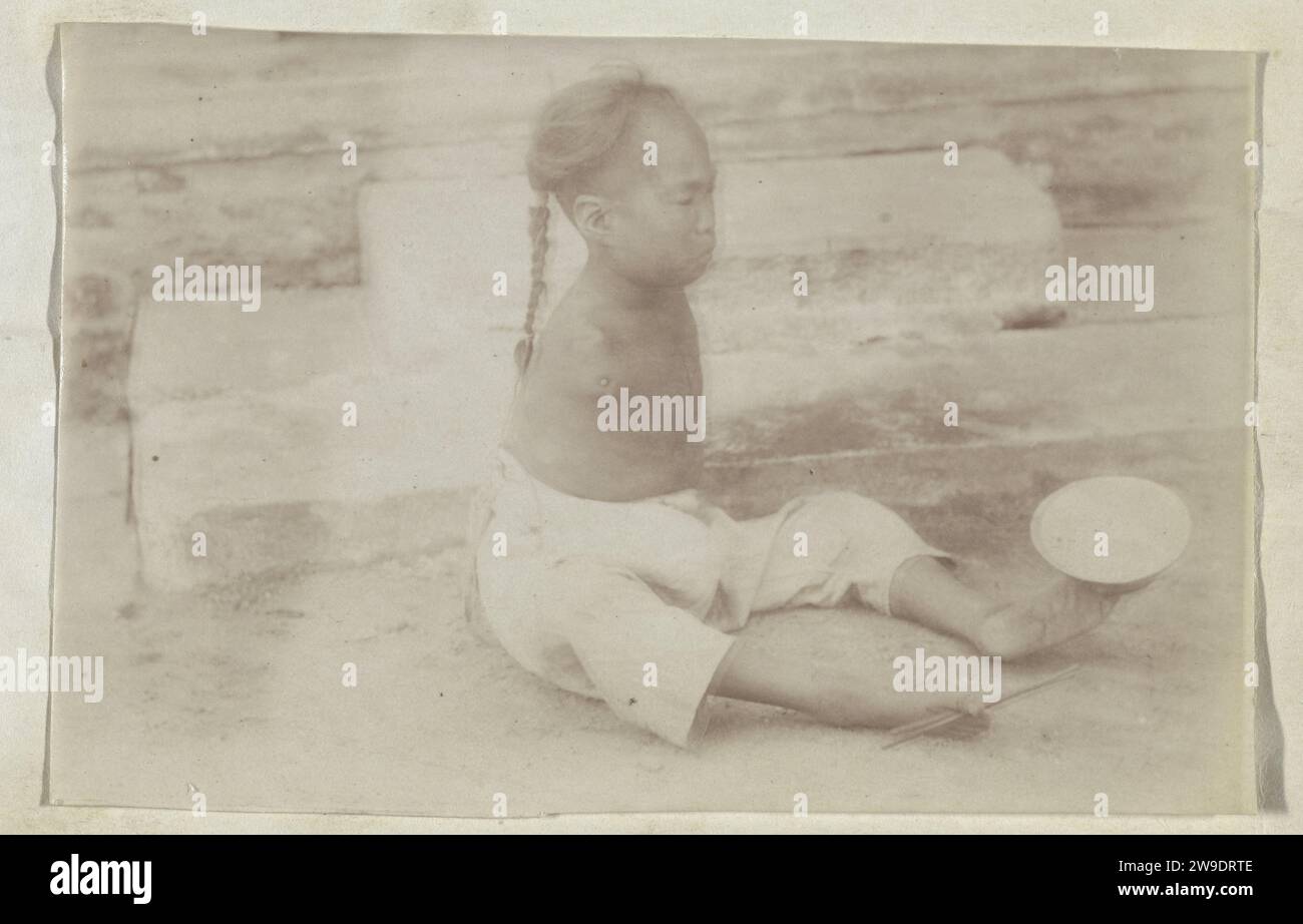 Chinese child without arms holds a bowl and eating utensils, c. 1879 ...