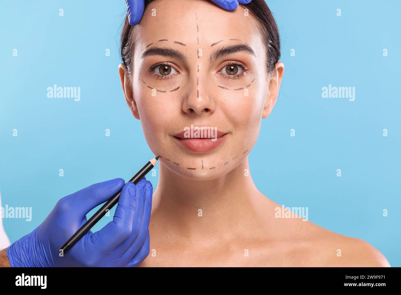 Doctor drawing marks on woman's face for cosmetic surgery operation ...