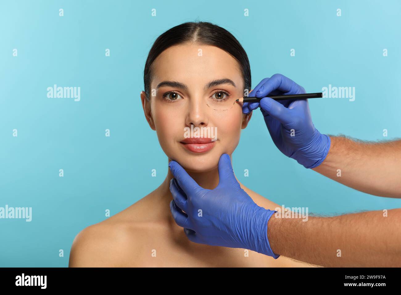 Doctor with pencil preparing patient for cosmetic surgery operation on ...