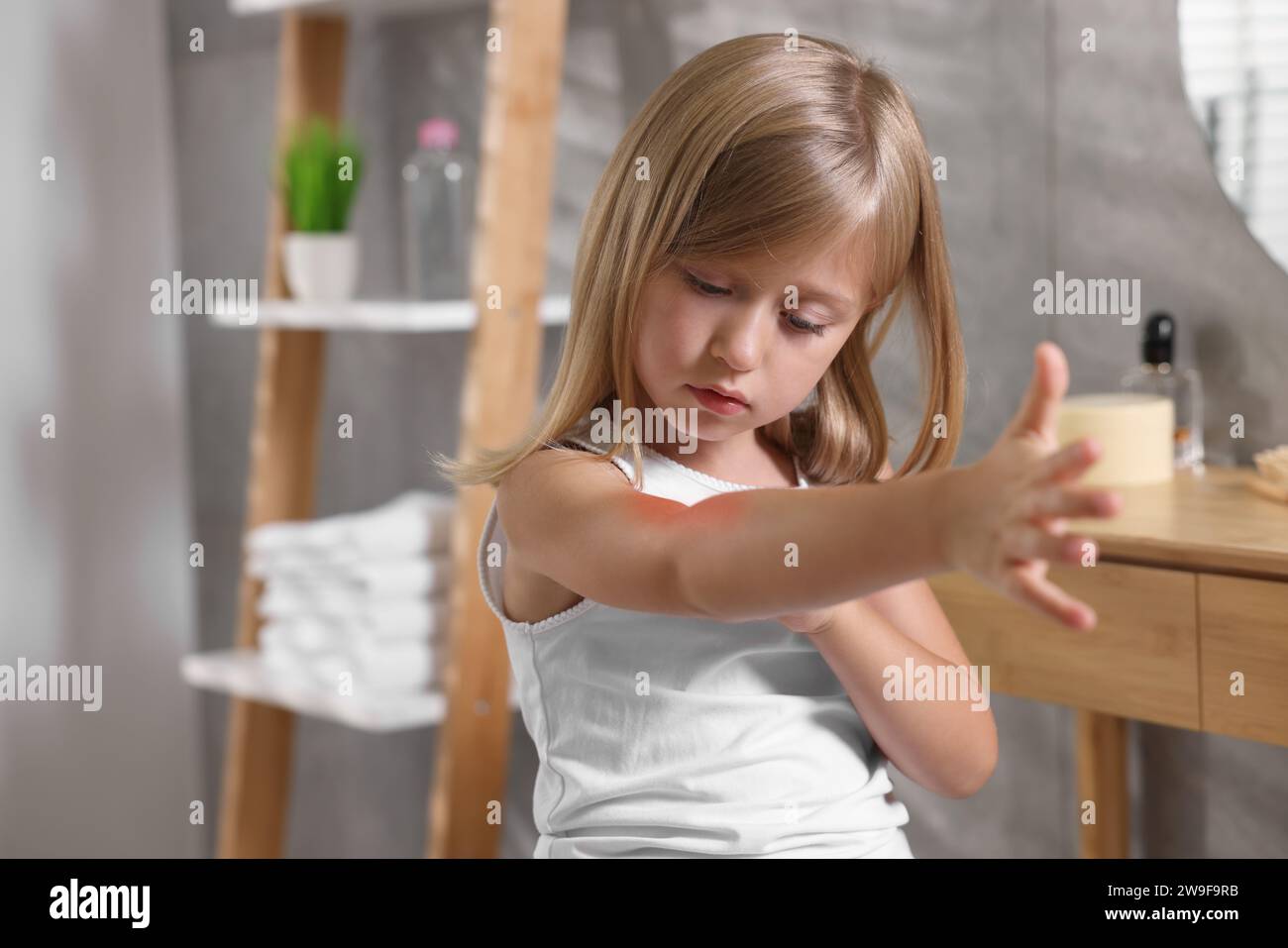 Girl scratching arm hi-res stock photography and images - Alamy