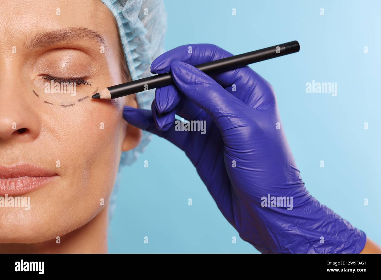 Doctor with pencil preparing patient for cosmetic surgery operation on ...