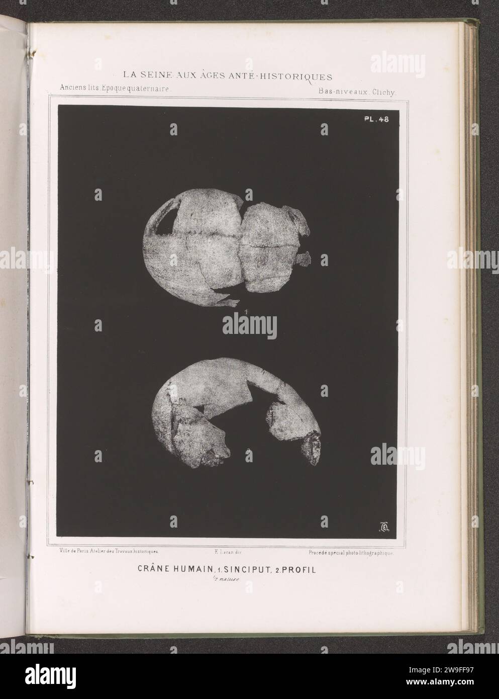 Two views of a human skull, top view and and profil, c. 1860 - in or ...