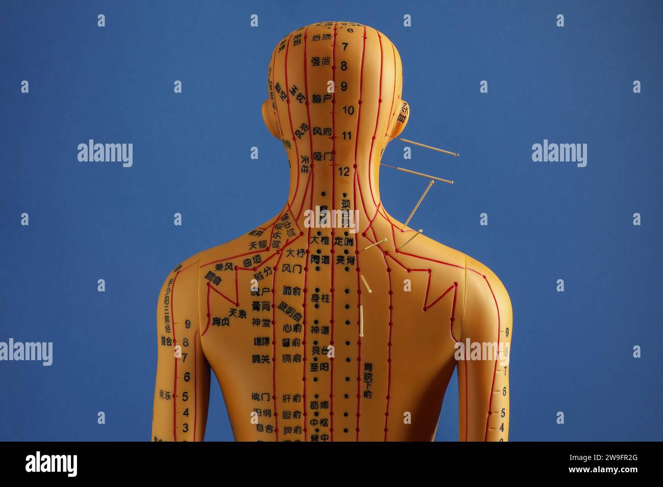 Acupuncture - alternative medicine. Human model with needles in back on ...
